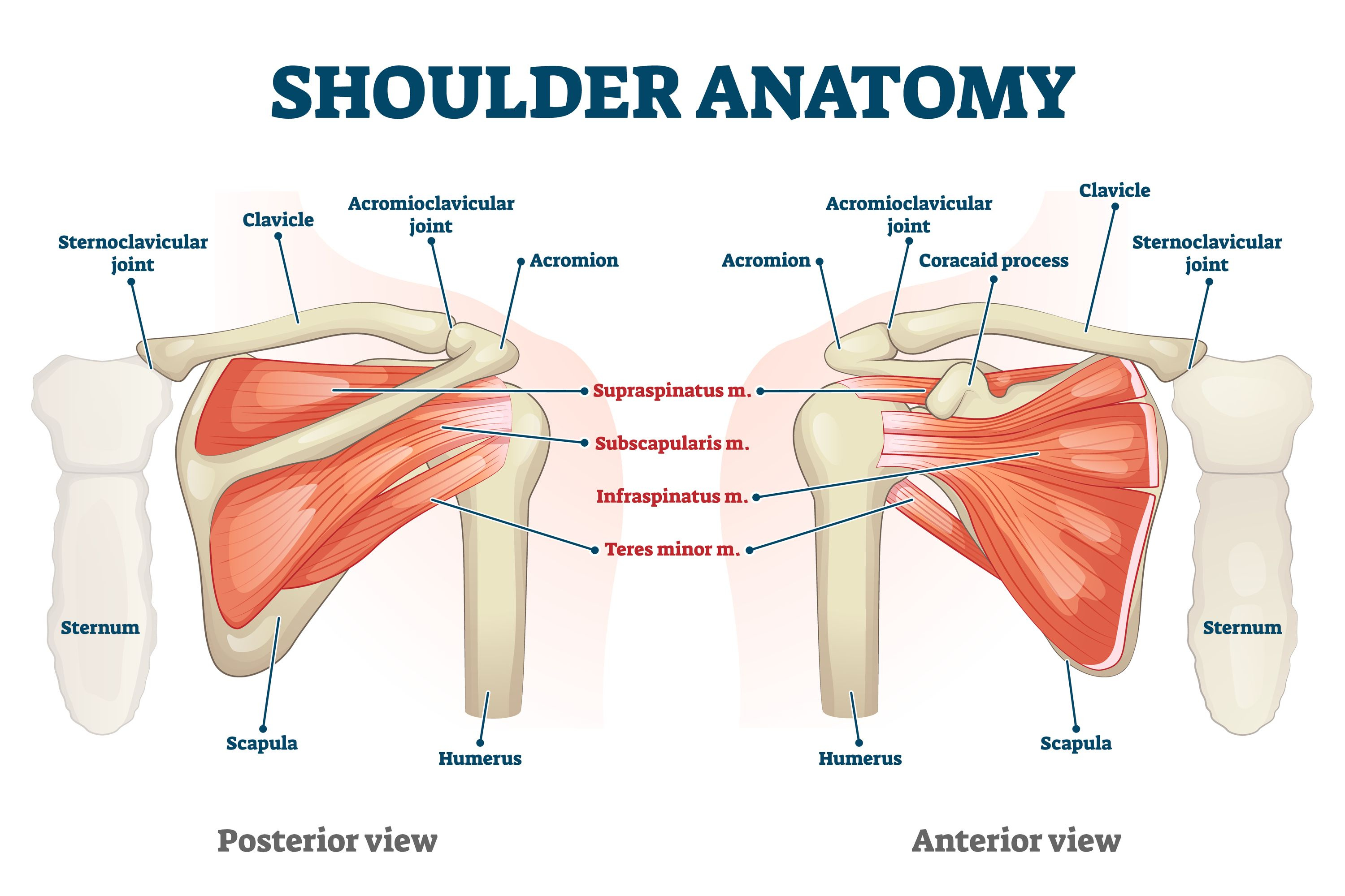 Shoulder Impingement: Why Does The Front Of My Shoulder Hurt? – Sport ...